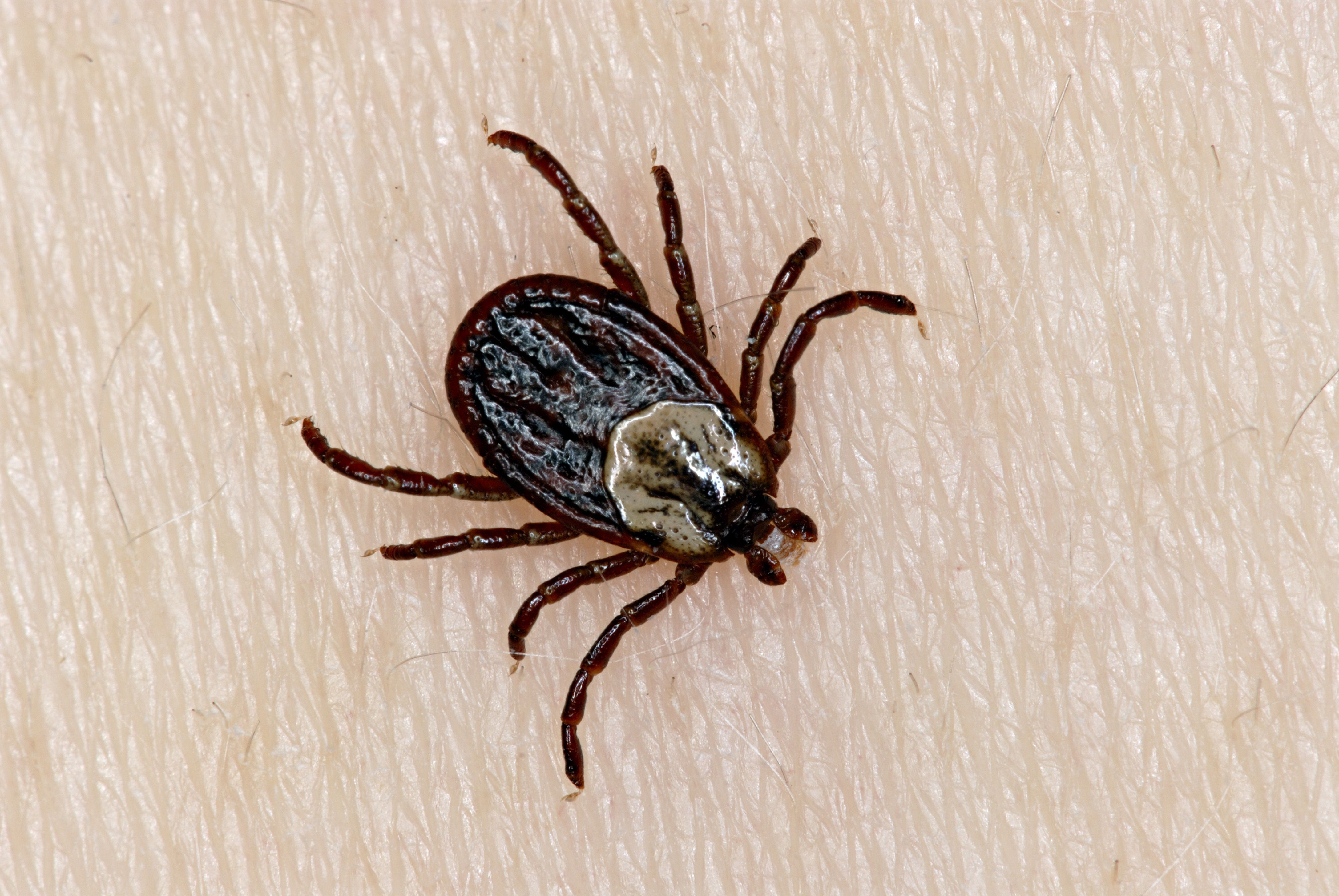 How "Blue Tick Pest Control" Can Revolutionize Your Backyard Experienc